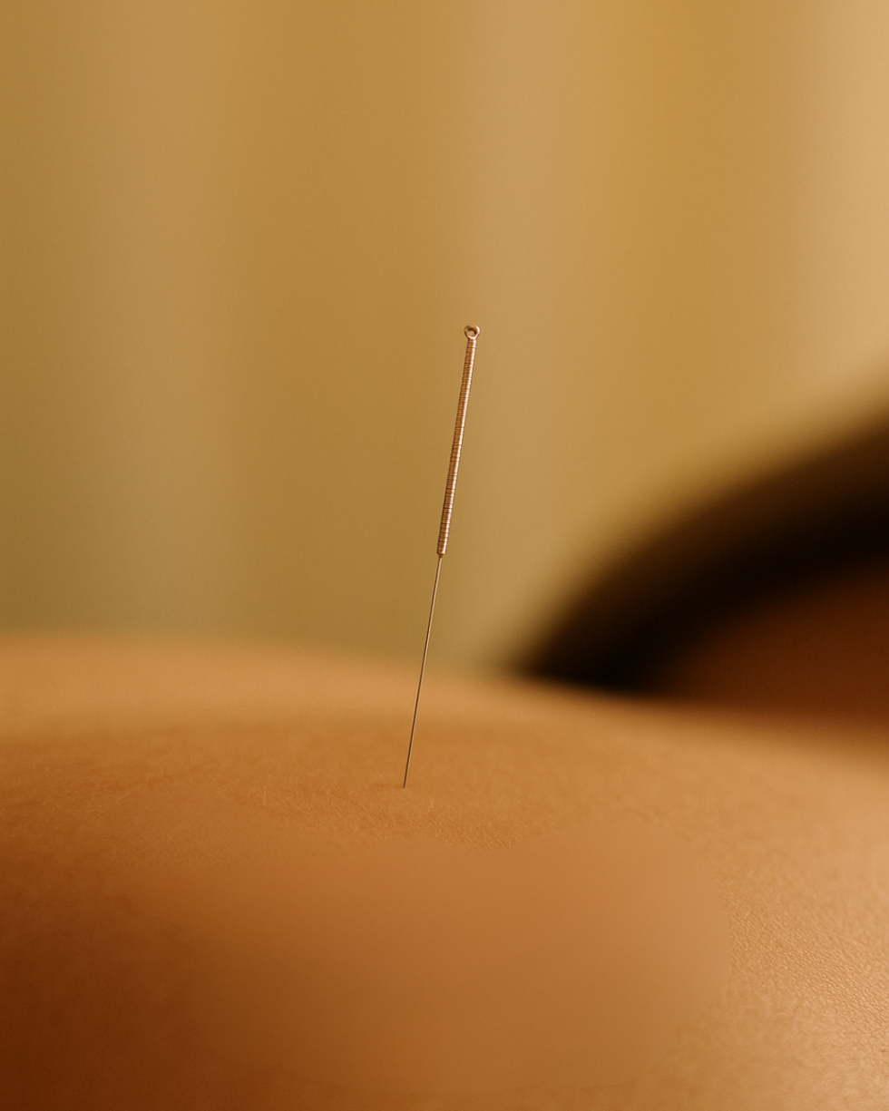 Acupuncture | Cultivate Your Wellness